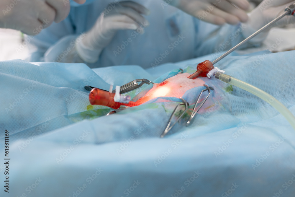 Against the background of the blue surgical field, the pet's abdomen is ...