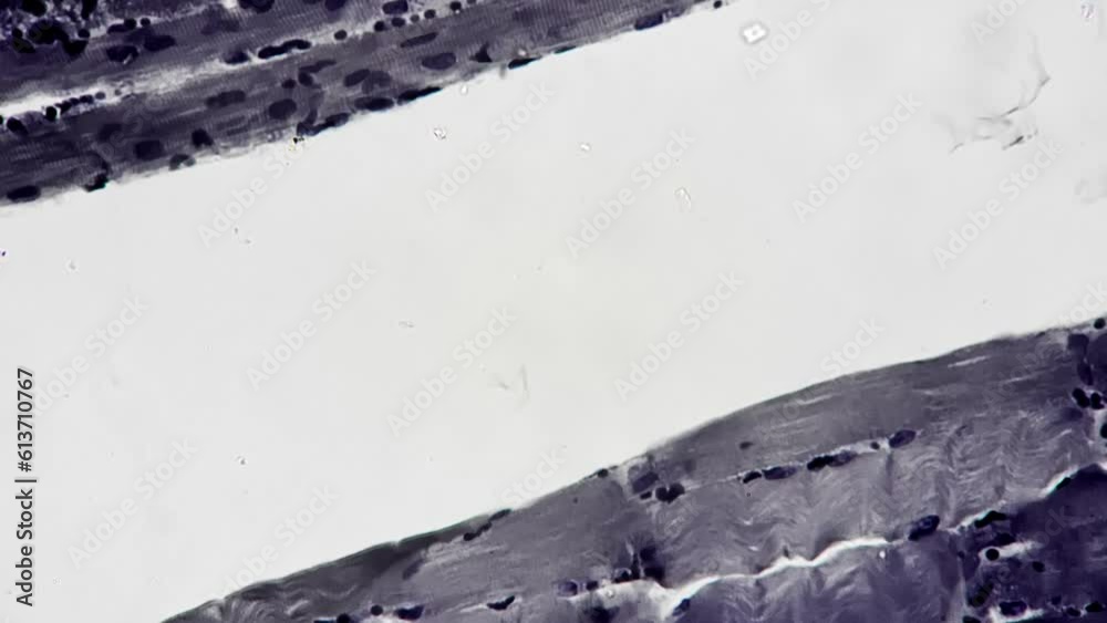 Human skeletal muscle under microscope 400x in longitudinal section ...