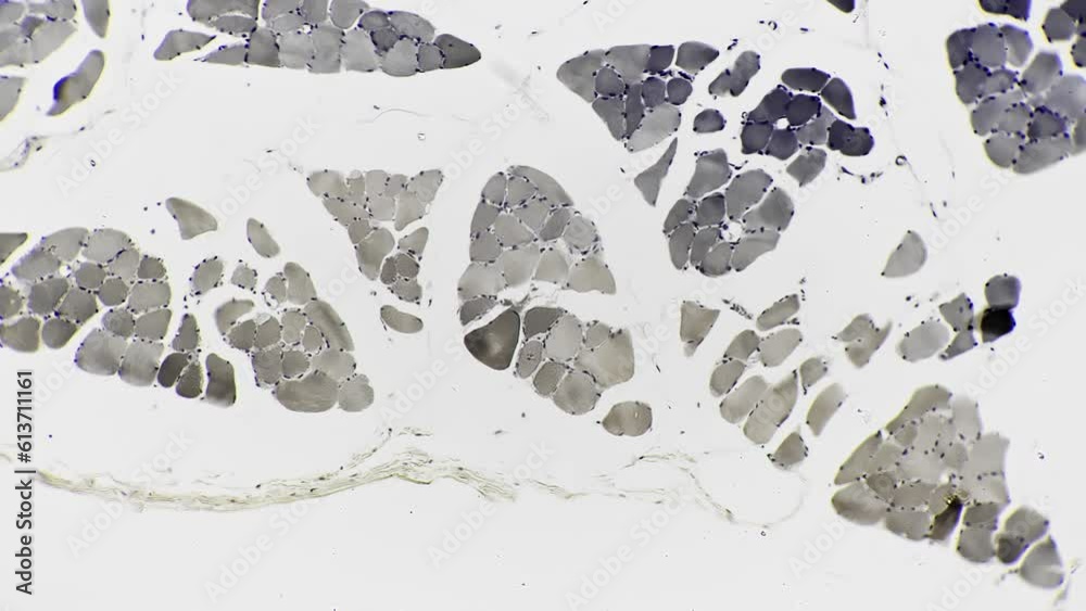 Human skeletal muscle under microscope with 200 times magnification on ...