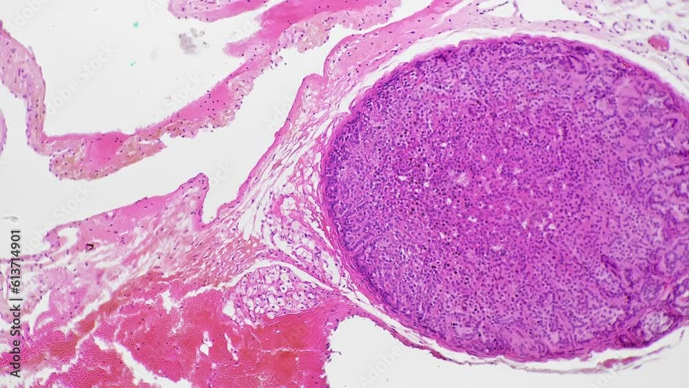 Section of human adrenal gland filmed under microscope 100x on white ...