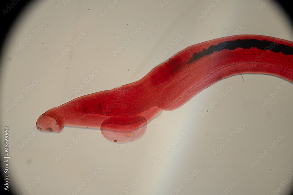 Poster photo of human parasite worms under the microscope – Wall Art ...