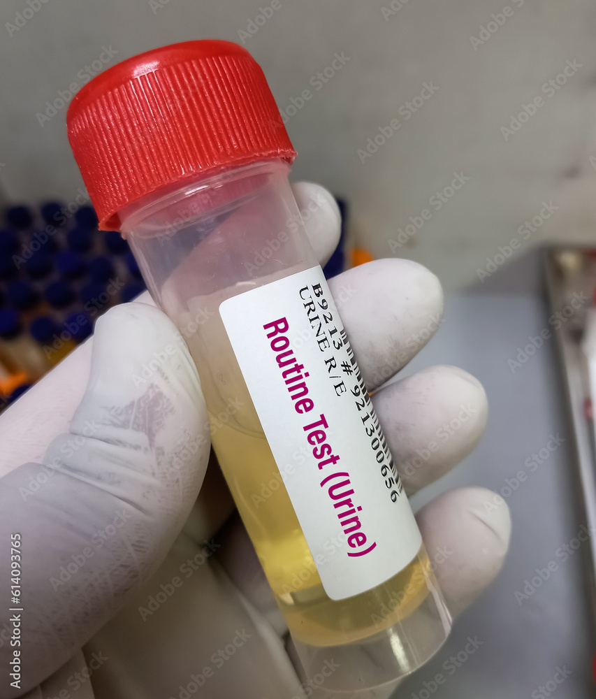 Medical technologist holding urine sample for routine examination or RE ...