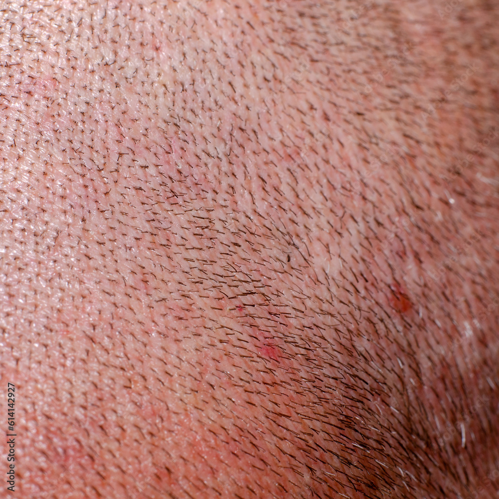 Shaved human skin on head close-up Stock Photo | Adobe Stock