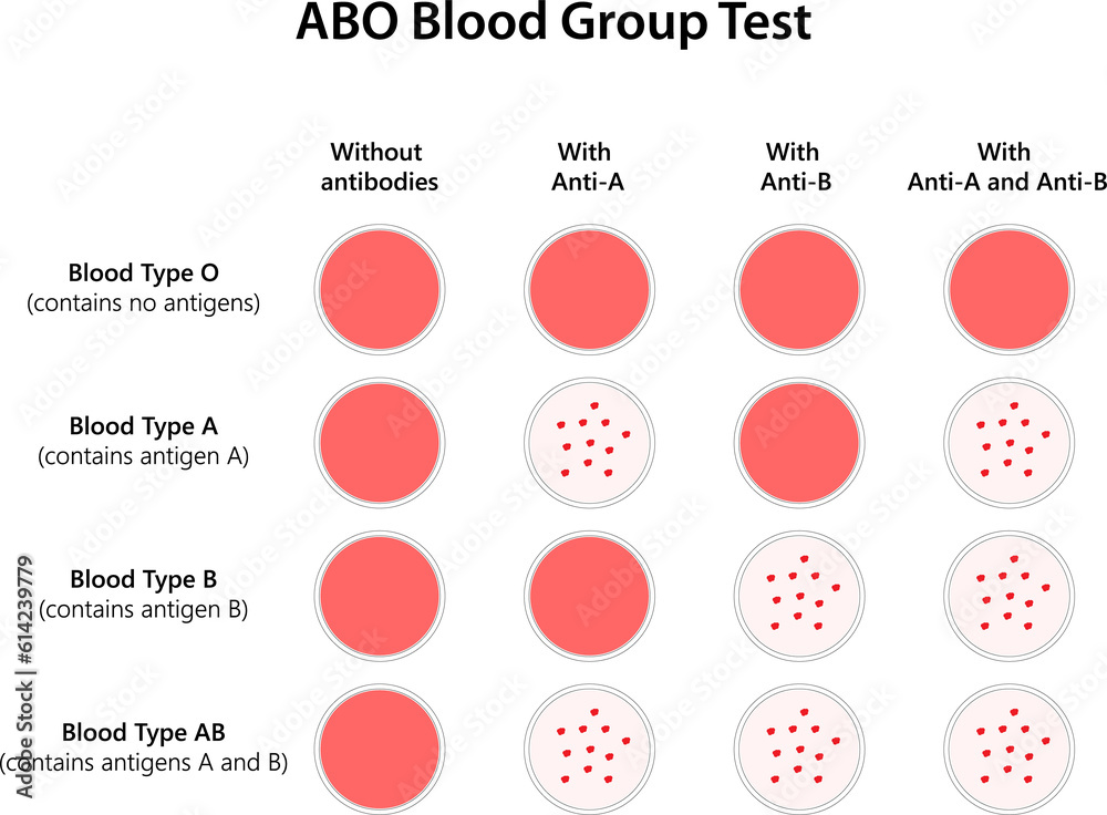 ABO Blood Group Test Stock-Illustration | Adobe Stock