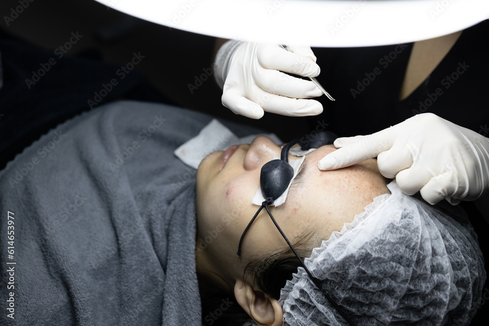 Hands of Dermatologist clearing blackhead,removing acne inflammation ...