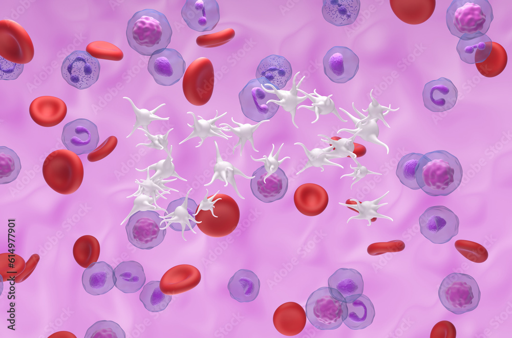 Essential thrombocythemia (ET), a blood cancer by the overproduction of ...
