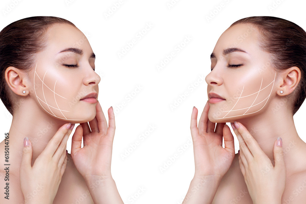 Woman before and after cheekbones shape correction. Stock Photo | Adobe ...