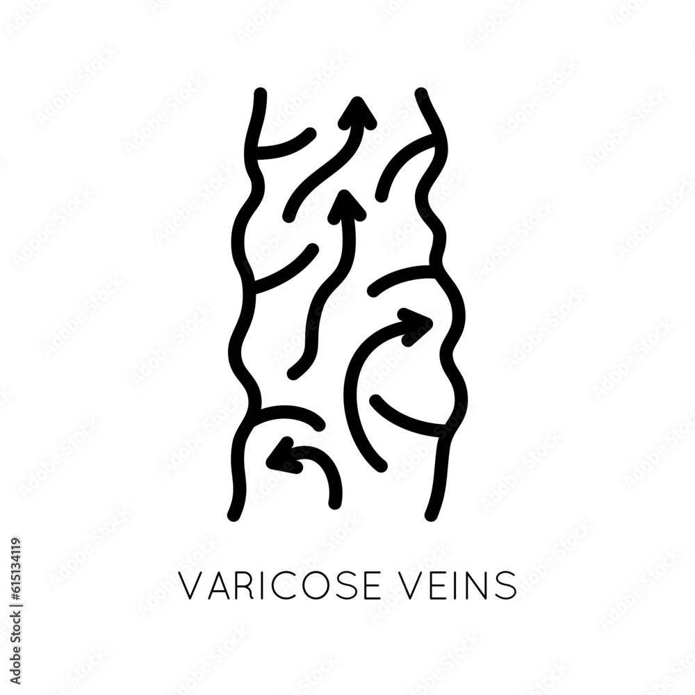 Varicose veins icon. Swelling of the vein, improper blood circulation ...