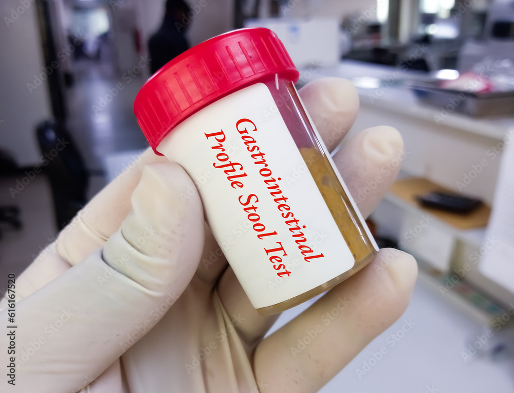 Technician holding feces sample for Gastrointestinal Profile stool test ...