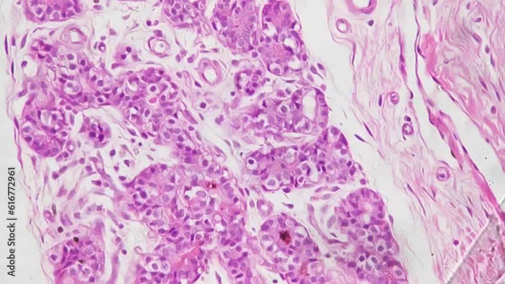 Macro footage of human bronchiolus tissue magnified in 200 times ...