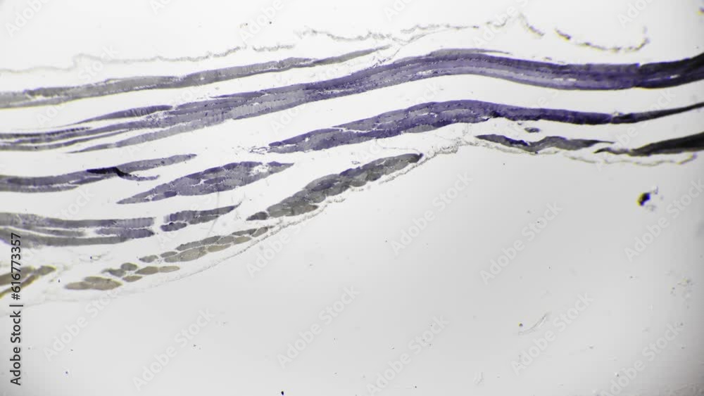 Longitudinal section of human skeletal muscle pattern filmed in lab ...