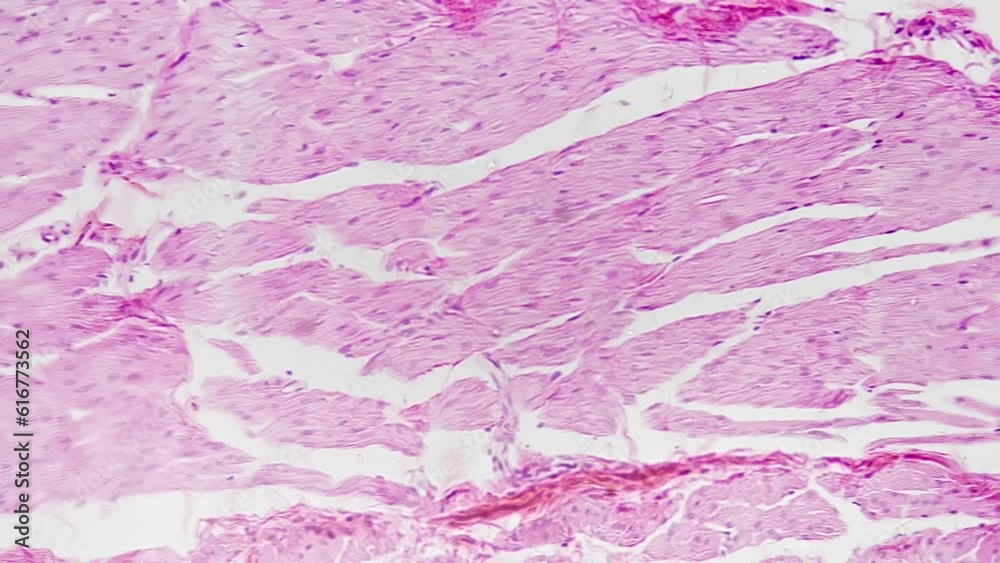 Transitional epithelium of man in section filmed under microscope 400x ...