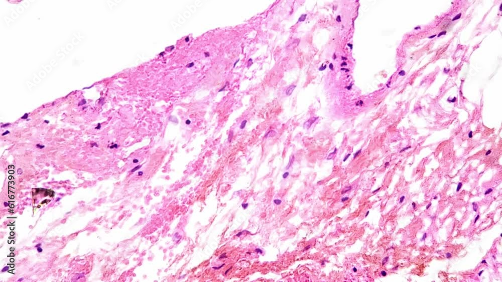 Section of adrenal gland of human being filmed under microscope 400x on ...