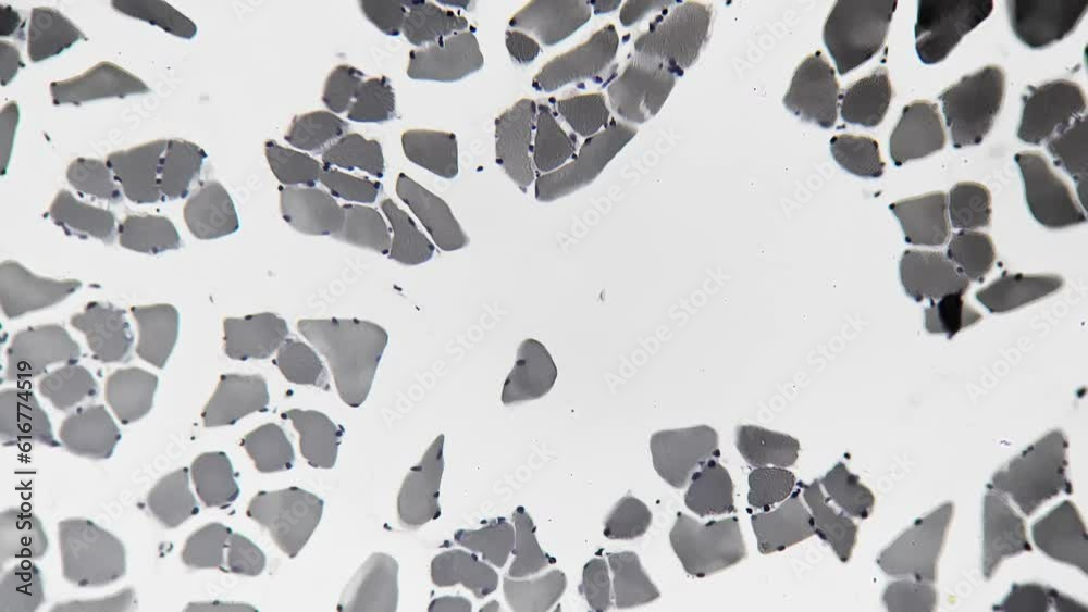 Human skeletal muscle filmed under microscope with 200 times ...
