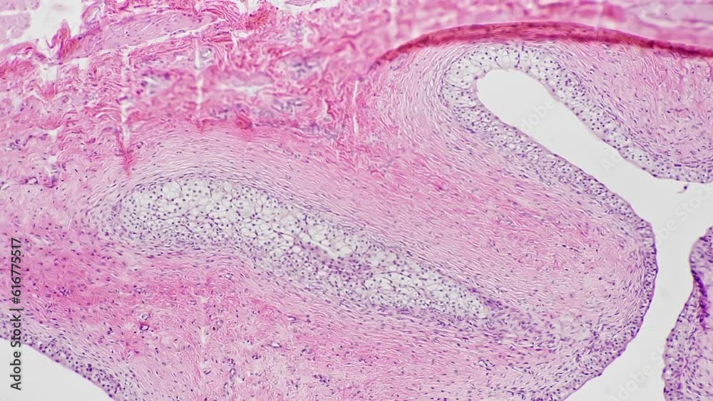 Transitional epithelium of man in section filmed under microscope 100x ...