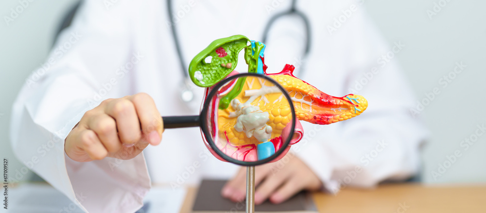 Doctor with human Pancreatitis anatomy model with Pancreas, Gallbladder ...