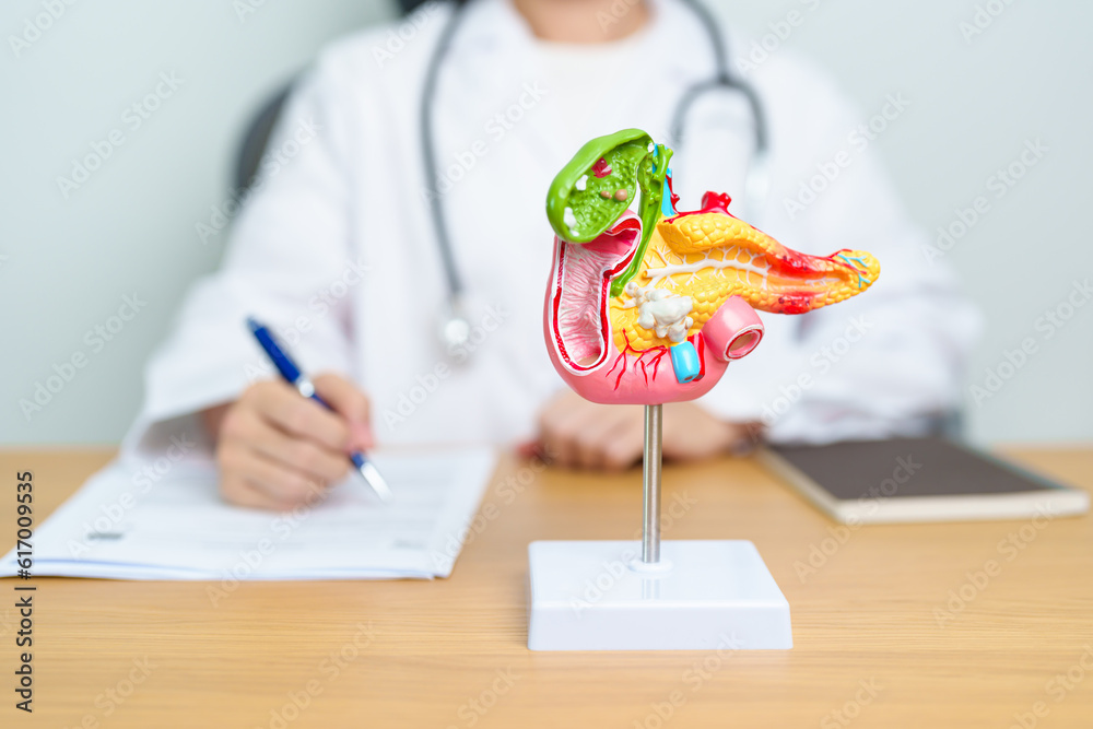 Doctor with human Pancreatitis anatomy model with Pancreas, Gallbladder ...