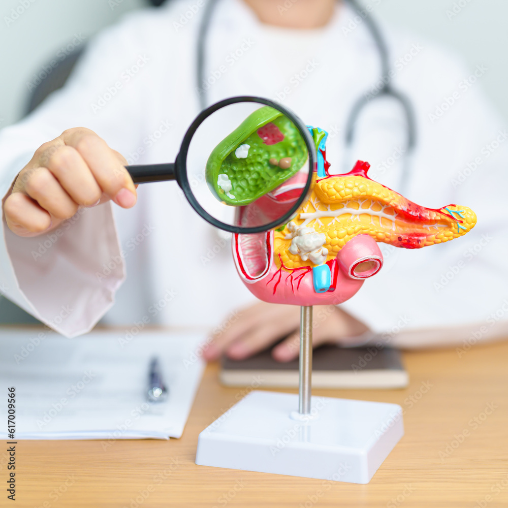 Doctor with human Pancreatitis anatomy model with Pancreas, Gallbladder ...