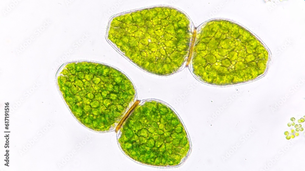 Freshwater green algae or phytoplankton, Pleurotaenium ovatum. Live ...