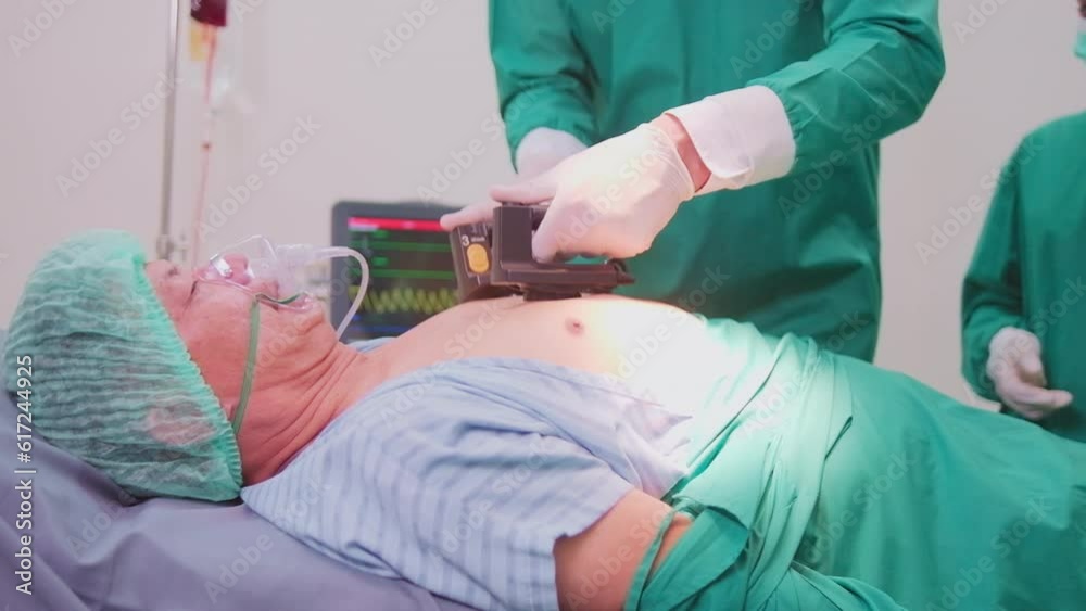 Vidéo Stock Professional ICU doctor's team CPR helps, defibrillating with defibrillators for ...