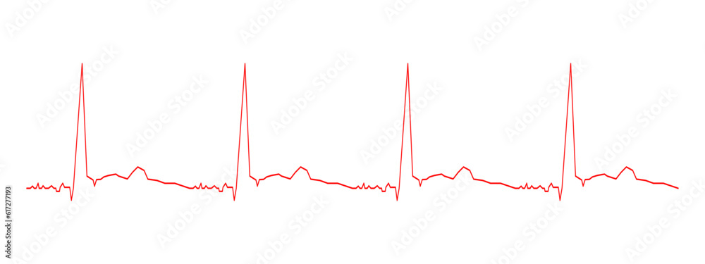 Red heartbeat diagram. Electrocardiogram chart. Heart cardiac rhythm ...
