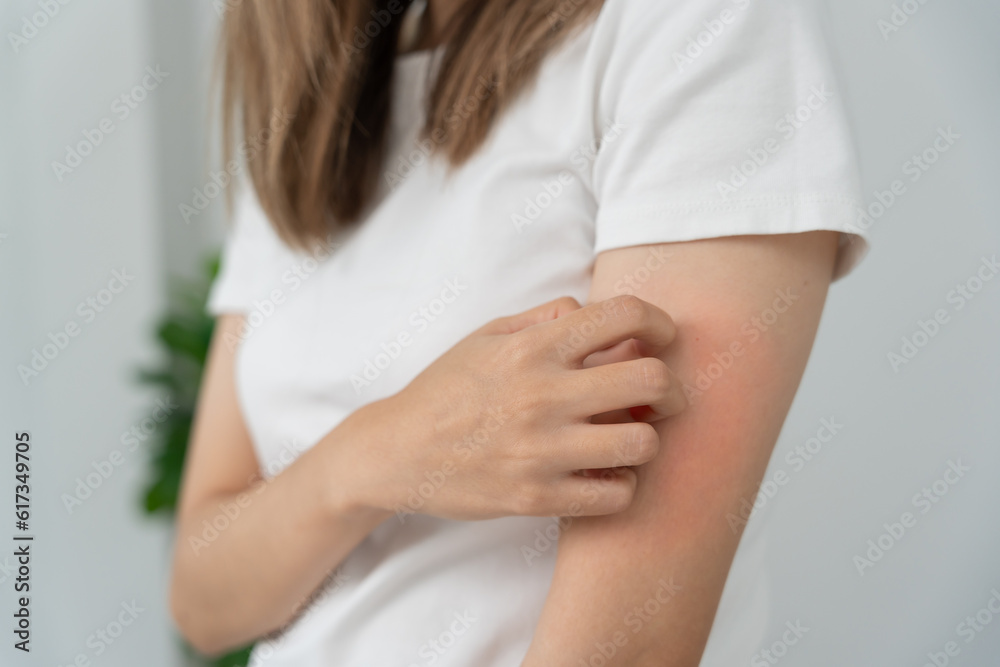 Foto de skin problem and beauty. Young woman scratch body has itchy ...