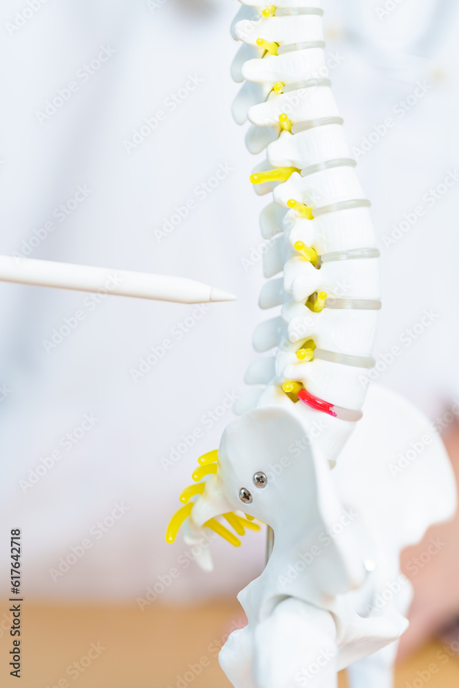 Doctor with human Spine anatomy model. Spinal Cord Disorder and disease ...