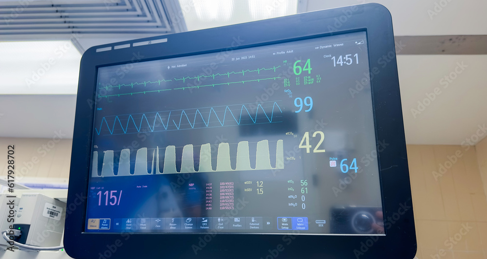 Medical vital signs monitor displaying critical health metrics - blood ...