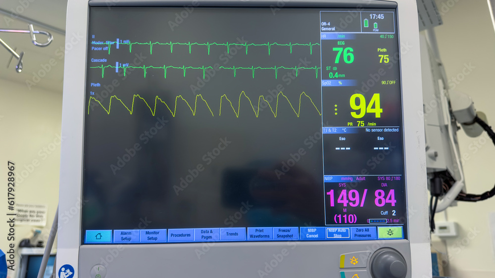 Medical vital signs monitor displaying critical health metrics - blood ...