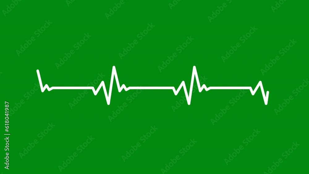 Heartbeat Pulse Rate animation Green Screen. Electrocardiogram beeping ...