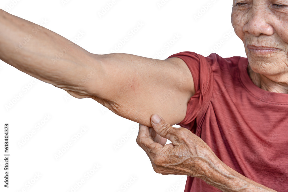 Close-up of an old Asian woman holding her arm showing wrinkles. Fat on ...