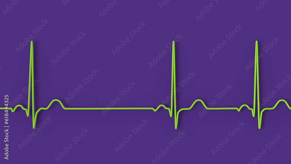 Electrocardiogram ECG displaying sinus arrhythmia, 3D illustration ...