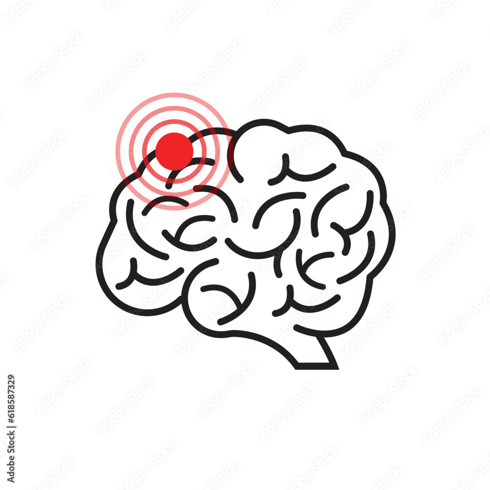 concussion brain or head ache thin line icon. linear trend modern ...