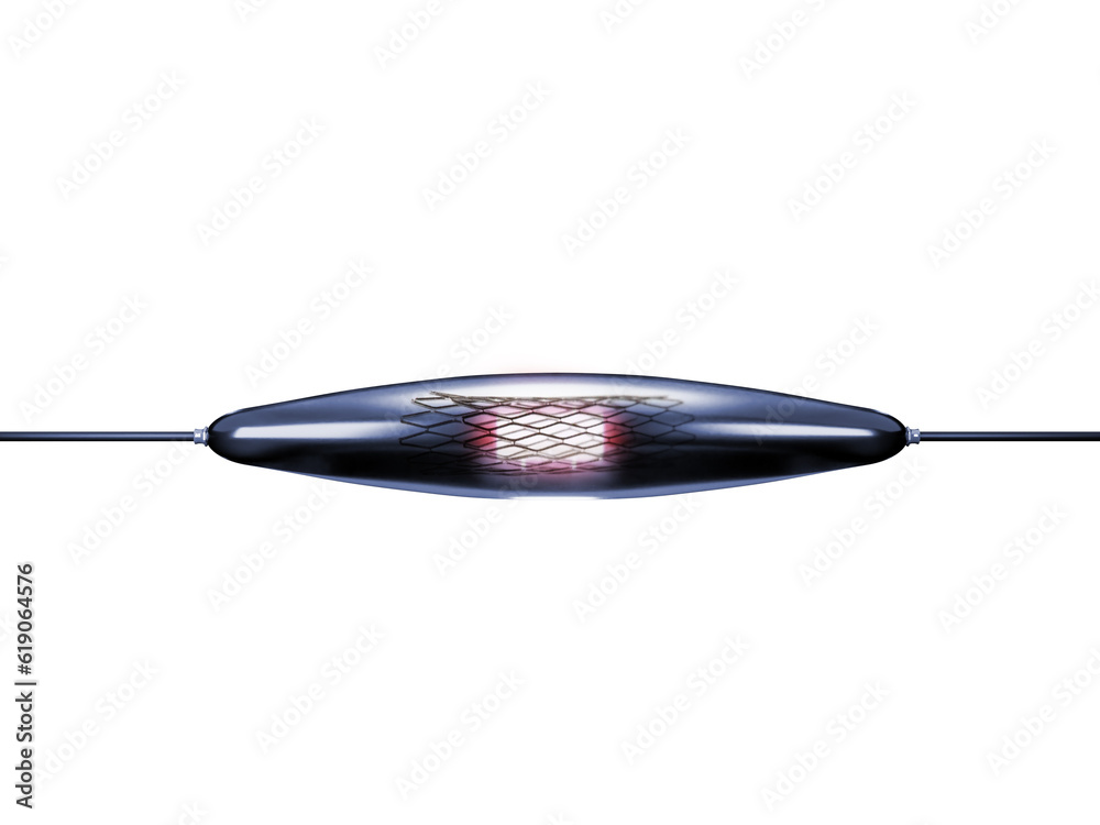 mesh metal nitinol self-expandable stent 3D rendering for endovascular ...