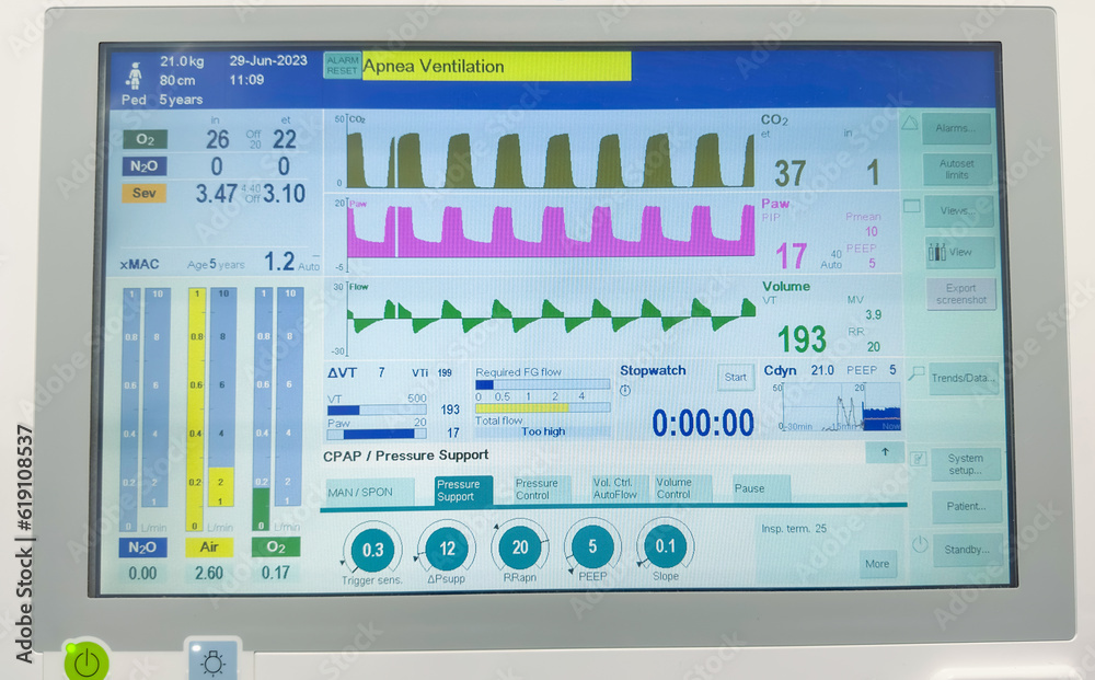 Hospital monitor displaying vital signs: heart rate, blood pressure ...