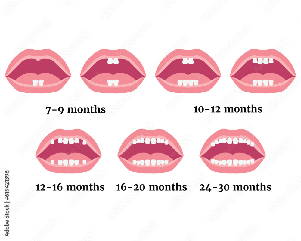 Stages of growth of milk teeth in children. Medical background or ...