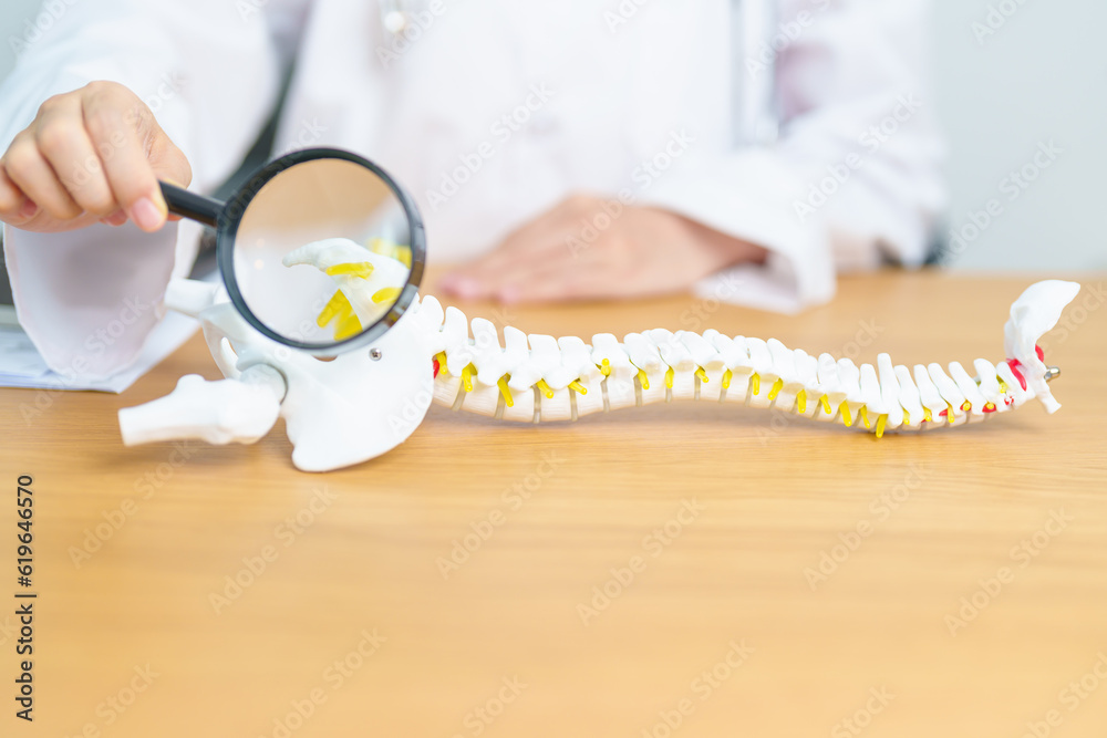 Póster Doctor with human Spine anatomy model – Cuadro para Pared ...