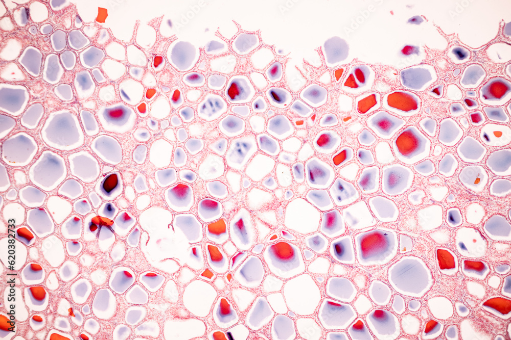Showing Light micrograph of the Thyroid gland and Thymus gland human ...