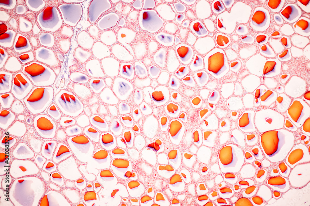 Showing Light micrograph of the Thyroid gland and Thymus gland human ...