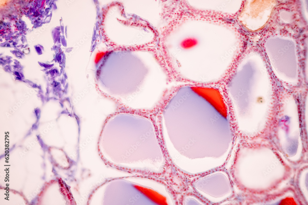 Showing Light micrograph of the Thyroid gland and Thymus gland human ...