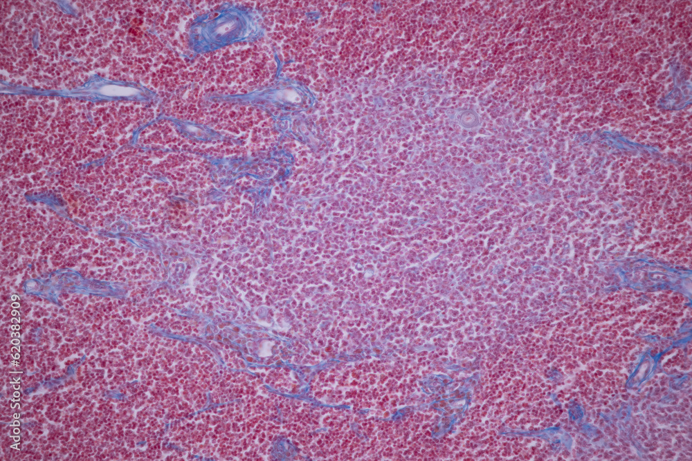 Showing Light micrograph of the Thyroid gland and Thymus gland human ...