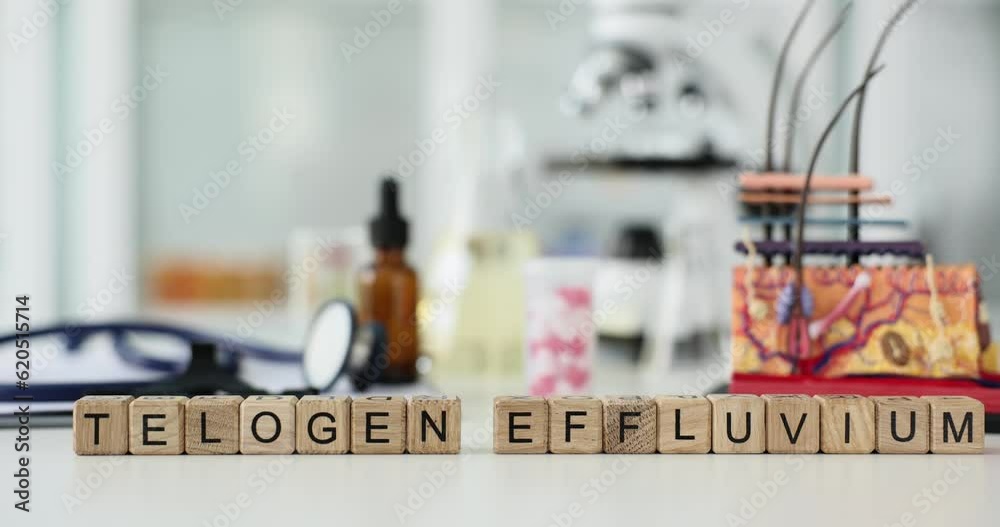 Causes of telogen effluvium and prevention and structure of skin and ...