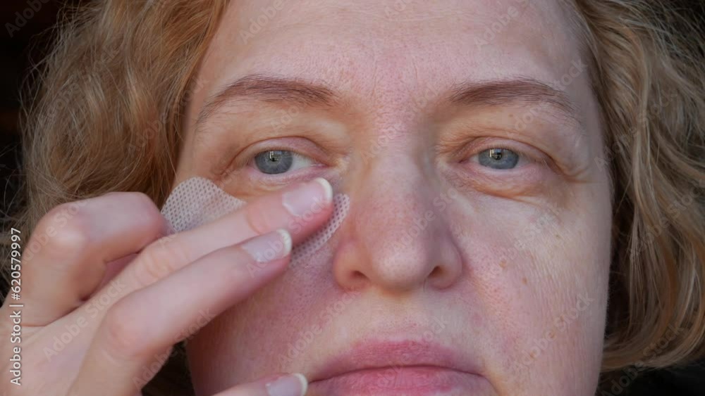 middle aged female's eye with drooping eyelid with patch for eyes ...
