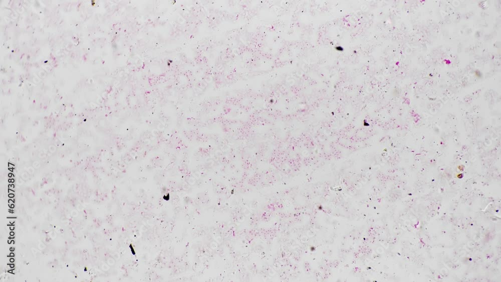 Blood smear magnified under microscope 100x against white background ...