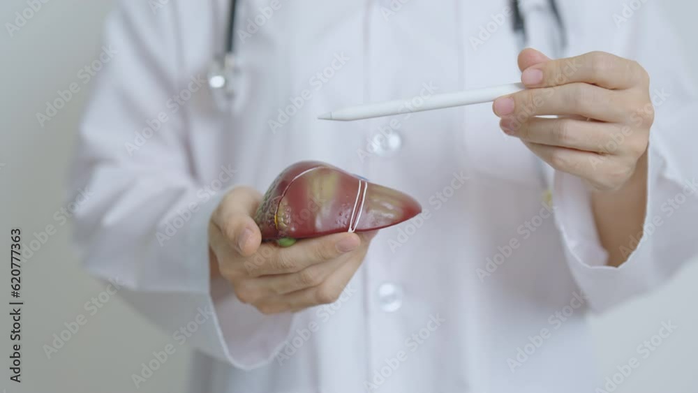 Doctor with human Liver model. Liver cancer and Tumor, Jaundice, Viral ...