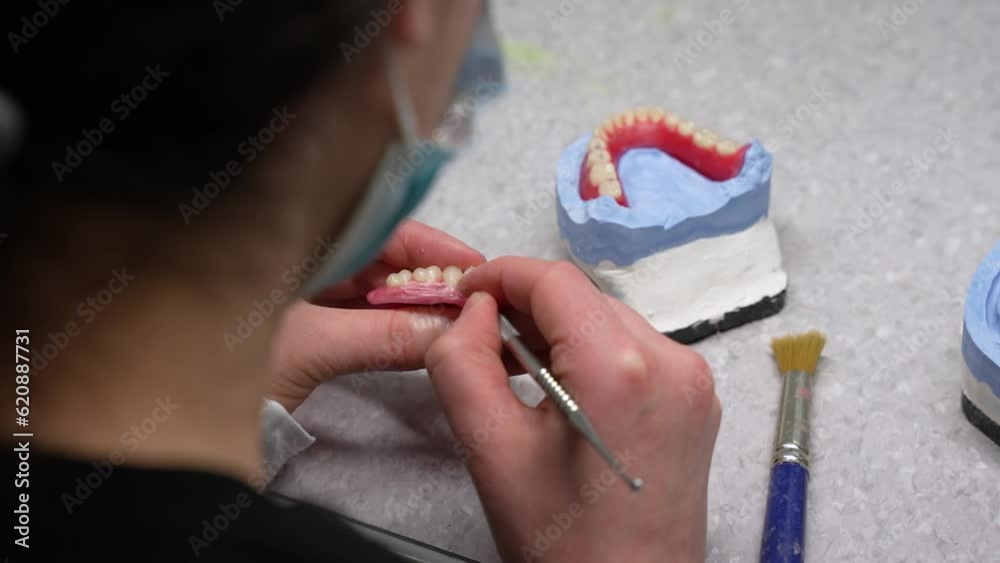 Making of dental prosthetic and carving out dents in artificial wax ...
