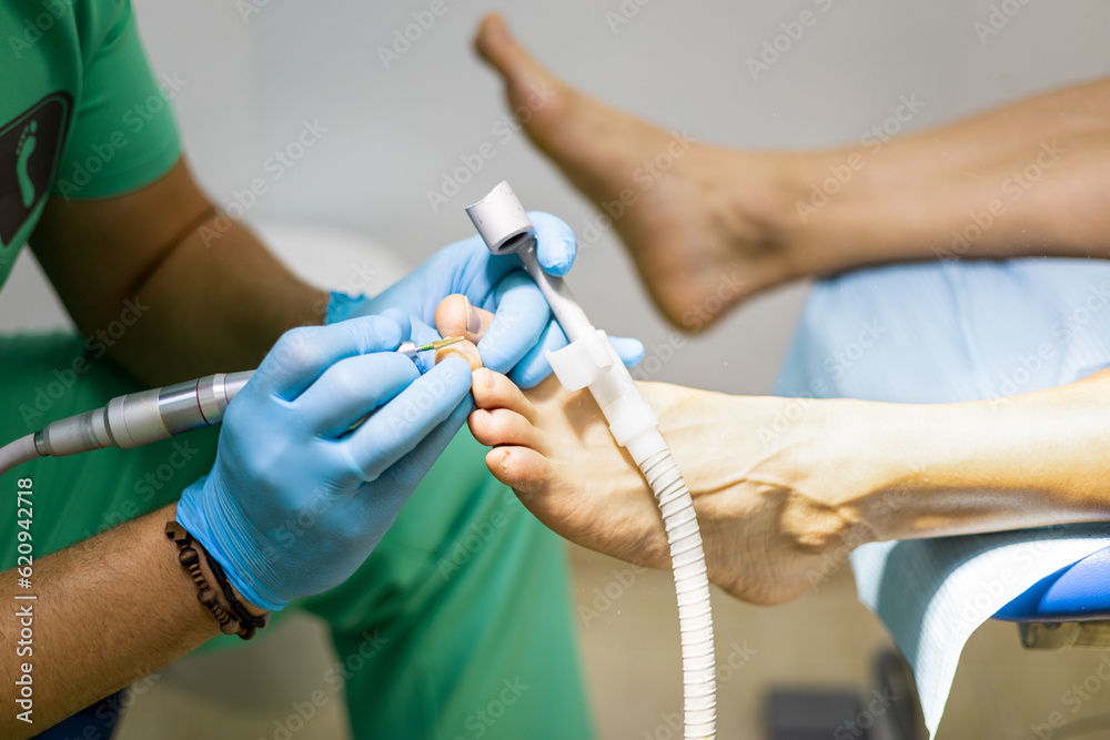 An unrecognizable podiatrist in uniform is using an electric pedicure ...