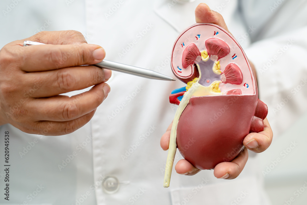 Kidney disease, Chronic kidney disease ckd, Doctor hold model to study ...