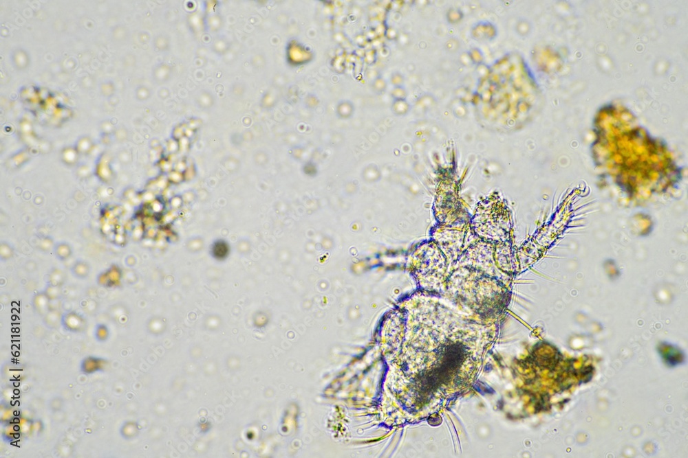 micro arthropods,soil microbes organisms in a soil and compost sample ...