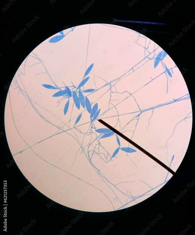 Microscopy of Microsporum gypseum, Microsporum gypseum microconidia ...